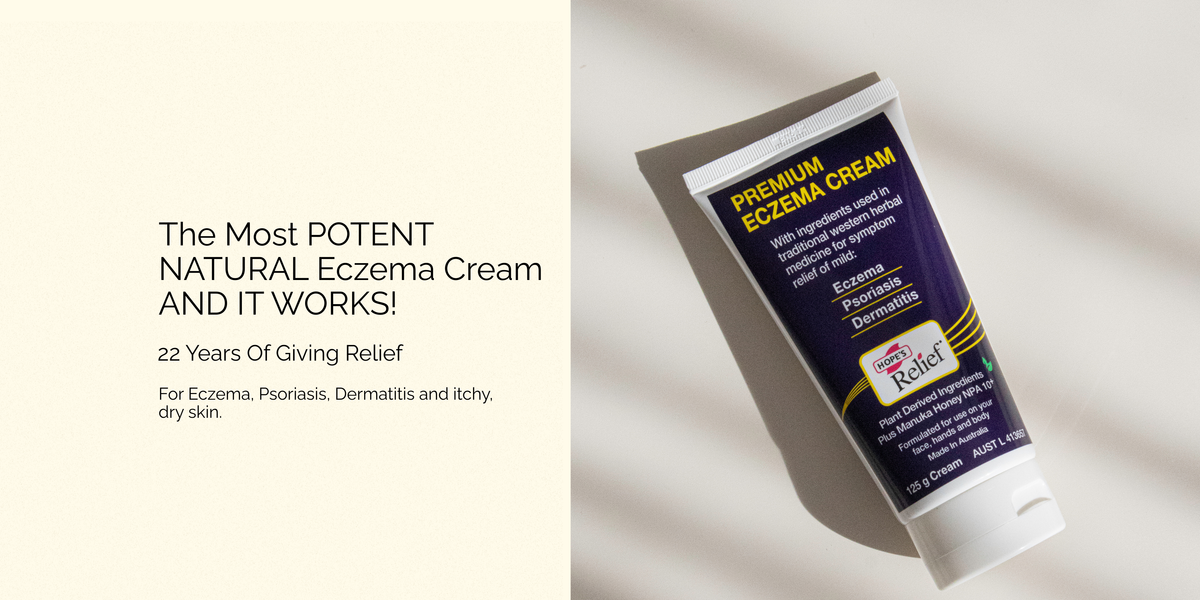 Hope’s Relief - Proven Steroid-Free Skincare for Eczema & Psoriasis ...