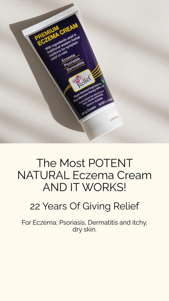 Hope’s Relief - Proven Steroid-Free Skincare for Eczema & Psoriasis ...