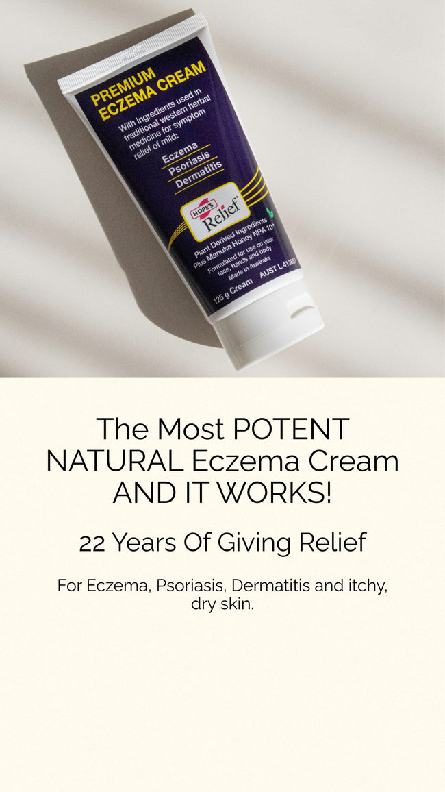 Hope’s Relief - Proven Steroid-Free Skincare for Eczema & Psoriasis ...